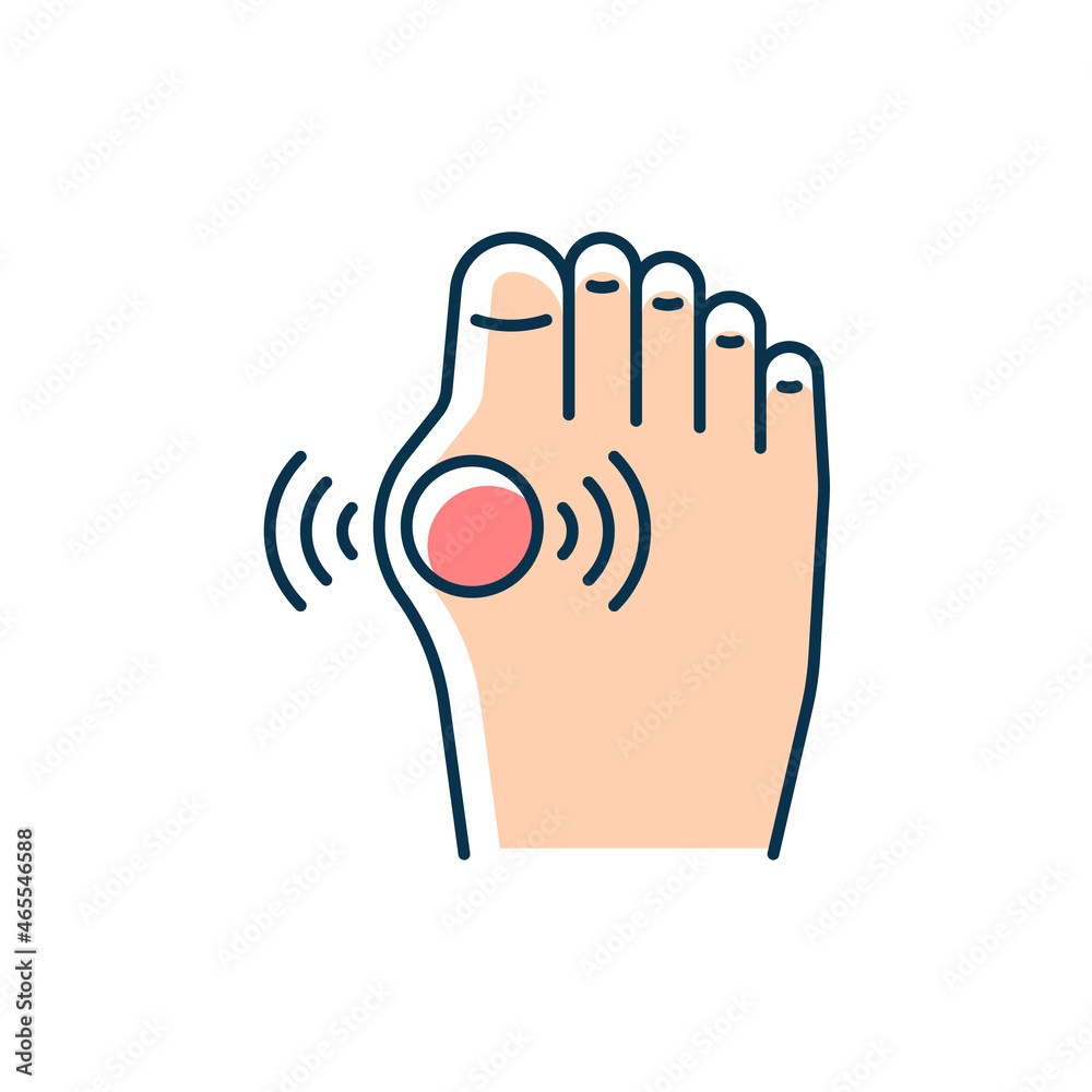 Gout RGB color icon. Inflammatory arthritis type. Uric acid buildup ...