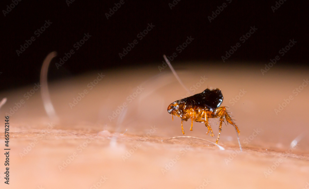 Flea on human skin close up. Extermination of parasites, insecticides ...