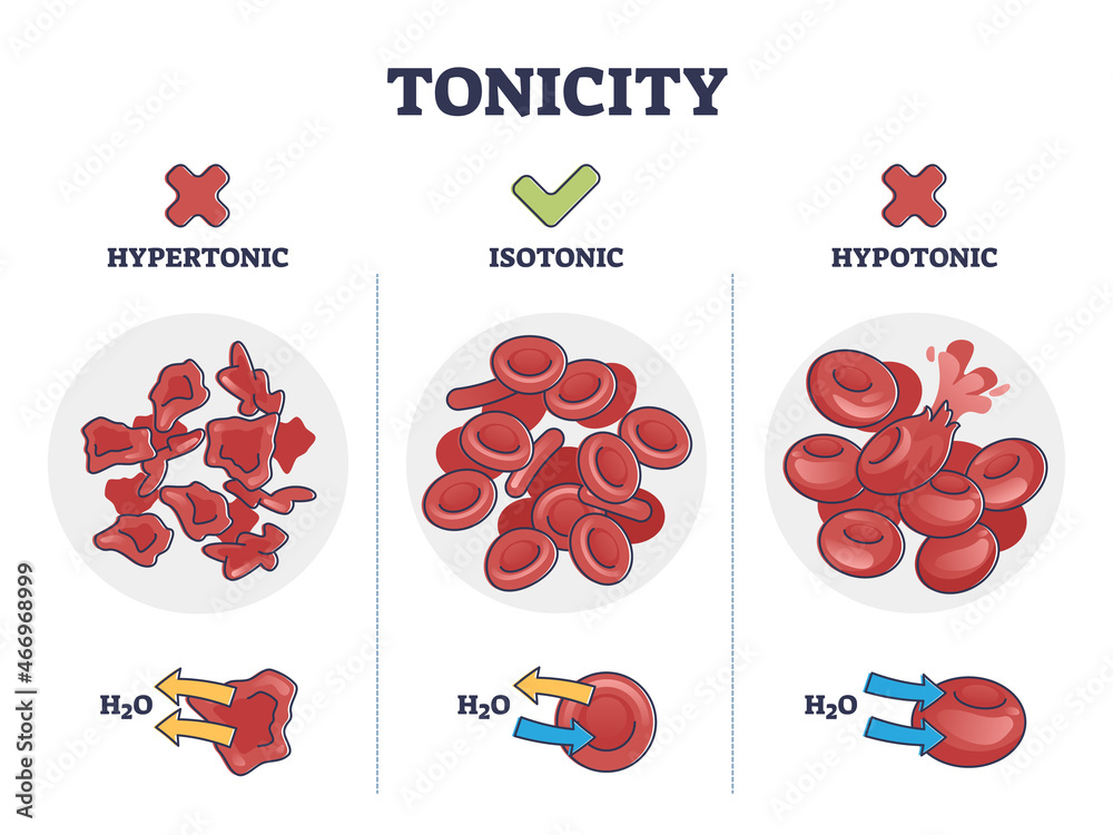 Tonicity as osmotic hypertonic, isotonic, hypotonic pressure outline ...