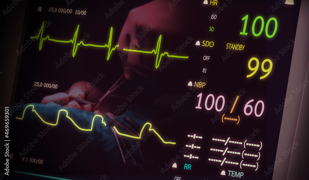 Patient monitor showing vital signs ECG and EKG. with a picture of a ...