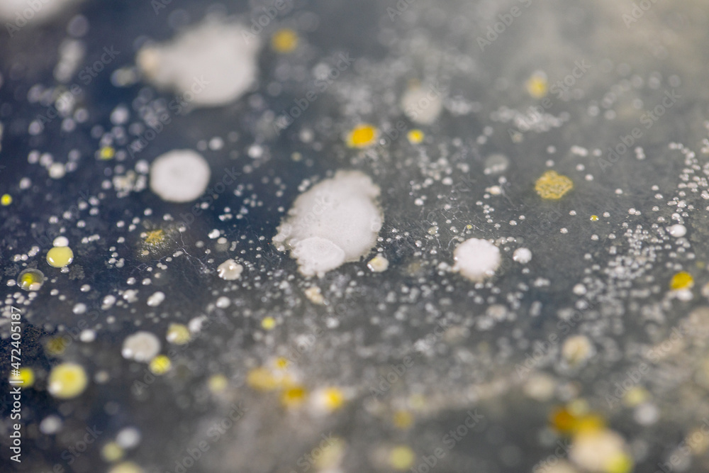 Backgrounds of Characteristics and Different shaped Colony of Bacteria ...