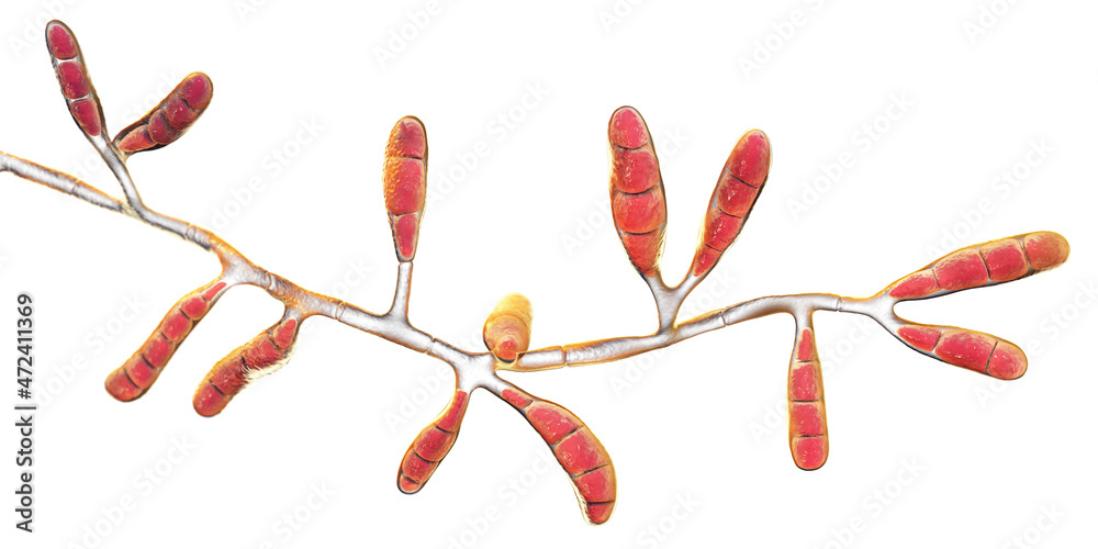 Microscopic fungi Epidermophyton floccosum, scientific illustration ...