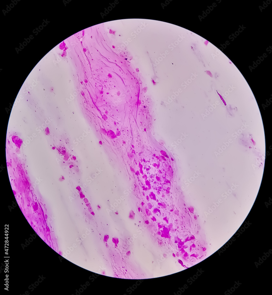 Gram staining, also called Gram's method, is a method of ...