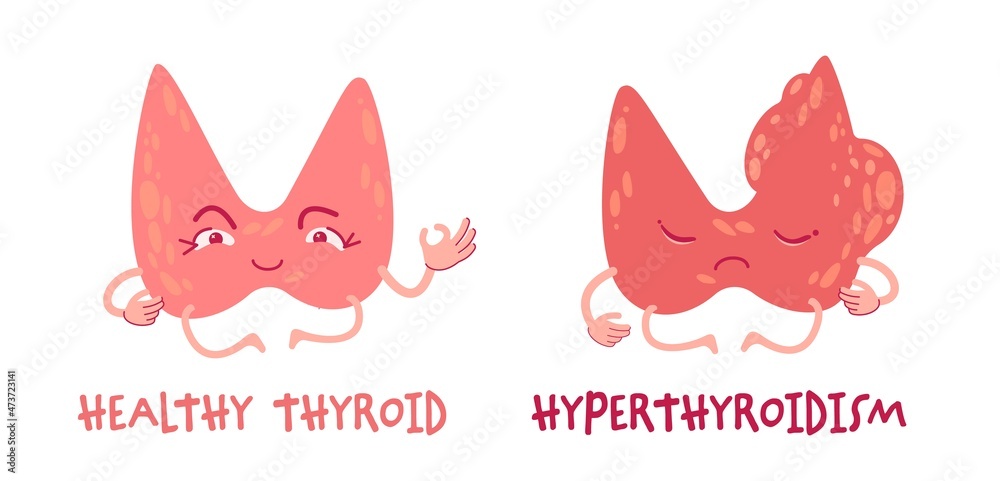 Healthy thyroid gland and hyperthyroidism, cartoon characters. Medical ...