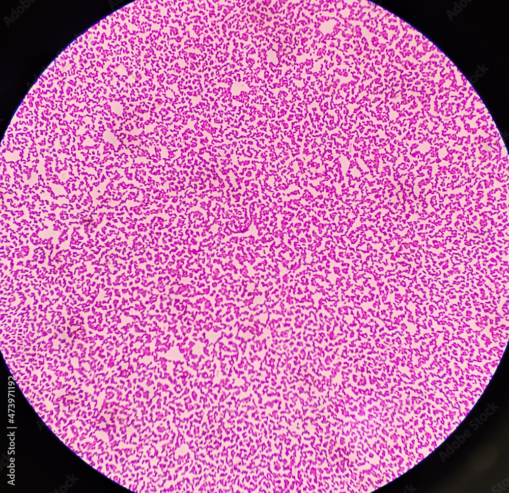 Foto de Stock Blood culture colonies gram stained microscopic 100x show ...