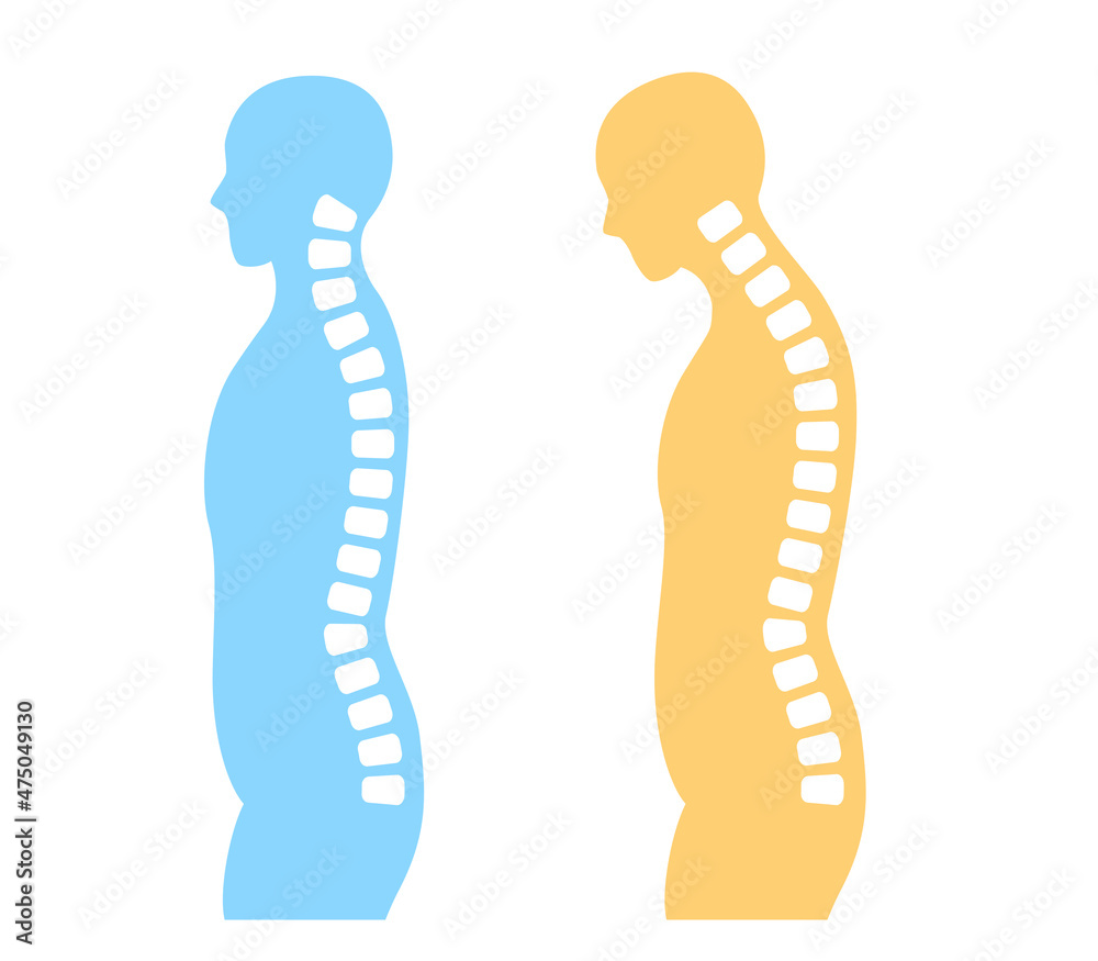 Rounded Shoulders and spine posture Human body silhouette Stock Vector ...