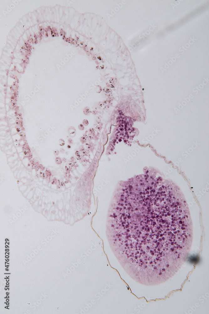 Hydra is a genus of small, fresh-water animals of the phylum Cnidaria ...