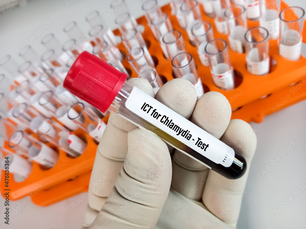 Blood sample for Chlamydia test(ICT), common sexually transmitted ...