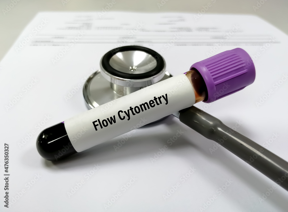 Blood tube with sample for Flow Cytometry test. To detect, identify and ...
