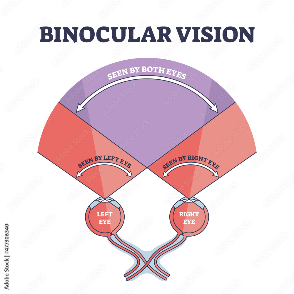 Binocular vision type explanation with right and left eye sight outline ...