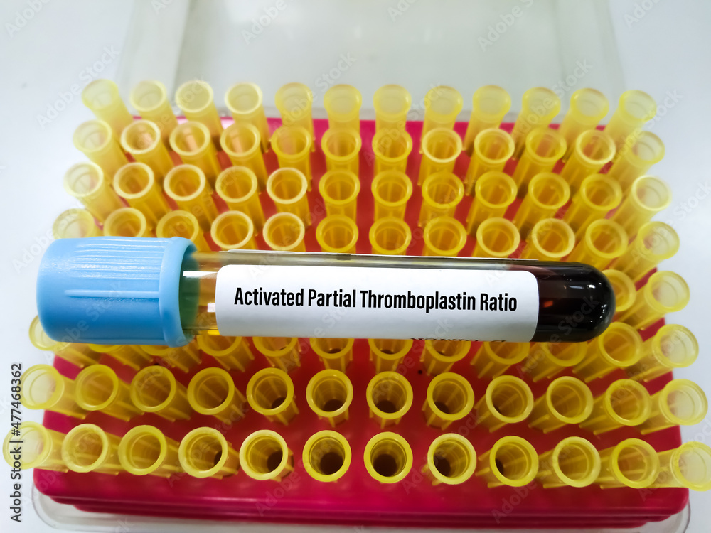 Blood sample tube for Activated Partial Thromboplastin Ratio (APTR ...