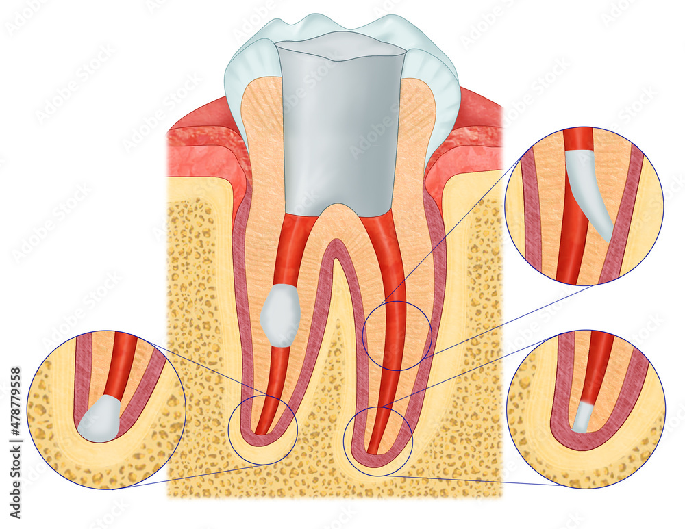 anatomy of the tooth illustration Stock Illustration | Adobe Stock