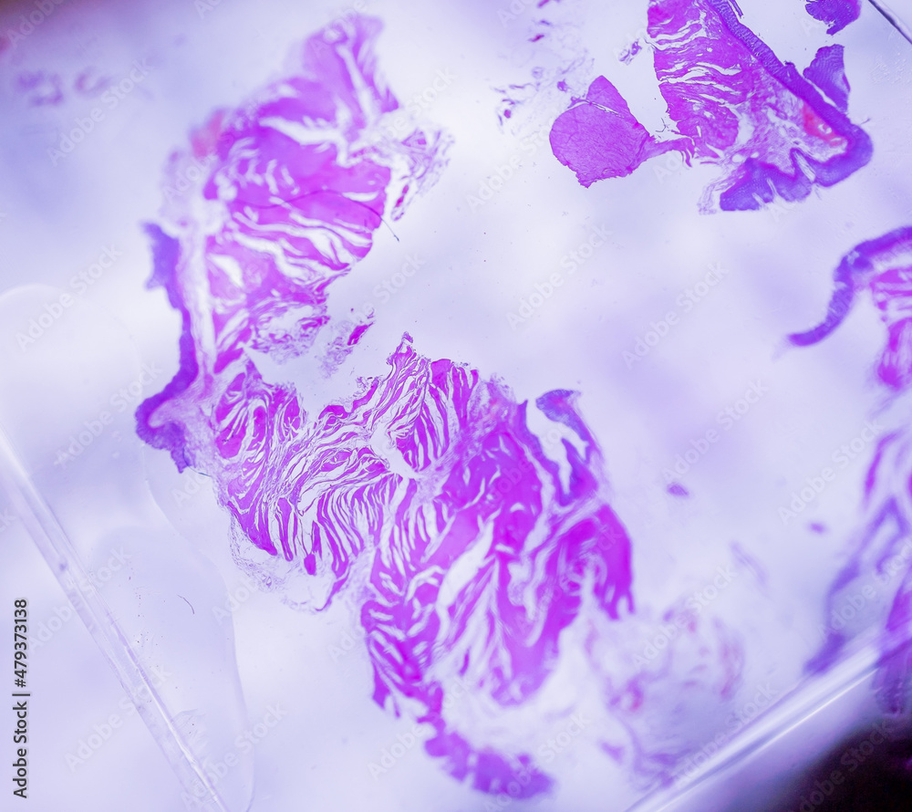 Inside microscope view at histology glass slide Stock Photo | Adobe Stock