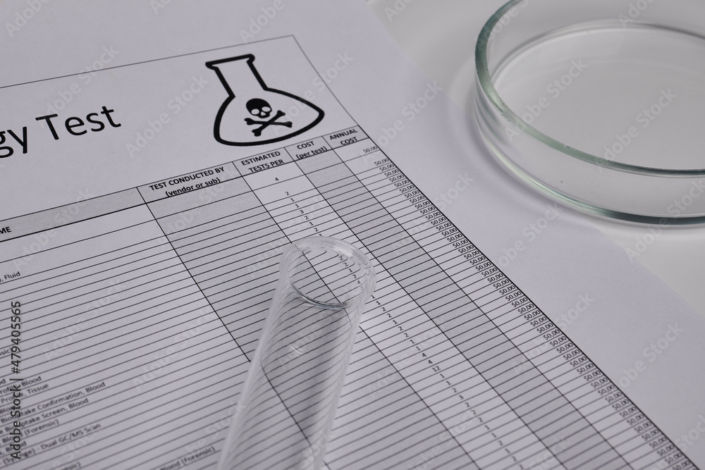 Toxic test log with petri dish and glass tube. Paper logs for ...