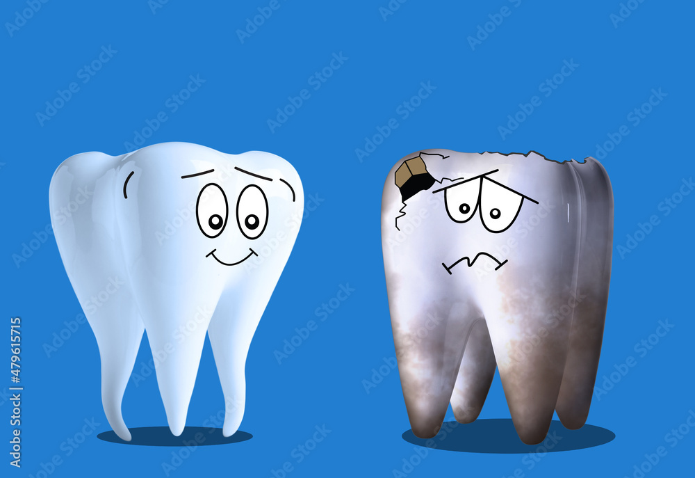 Healthy and unhealthy teeth on blue background, illustration. Dental ...