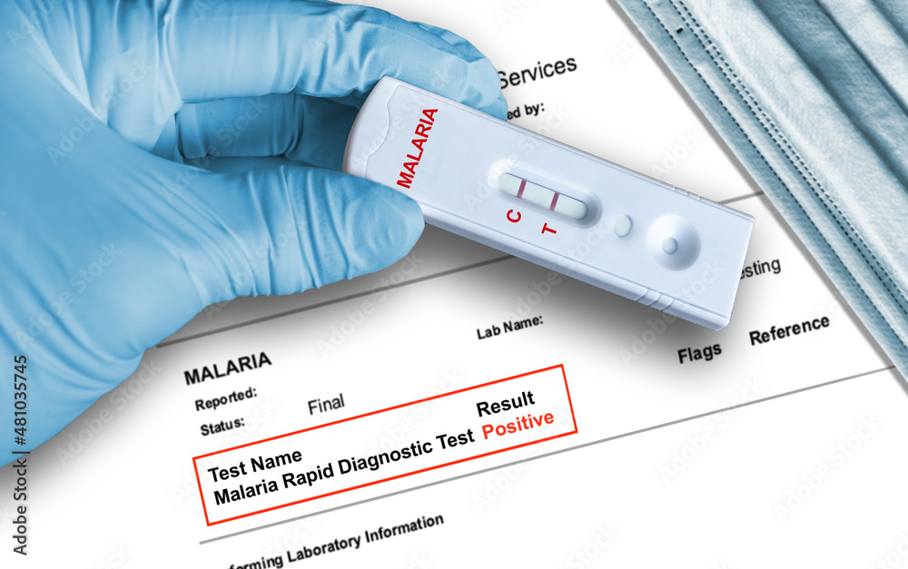 Positive Malaria rapid diagnostic test result by using rapid testing ...