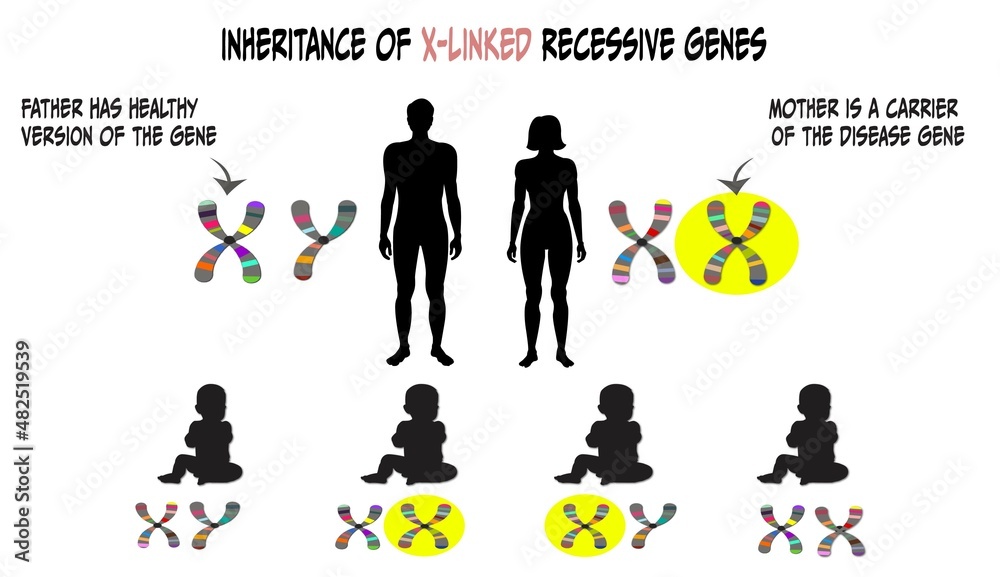 Inheritance of X chromosome linked recessive genes when mother is a ...
