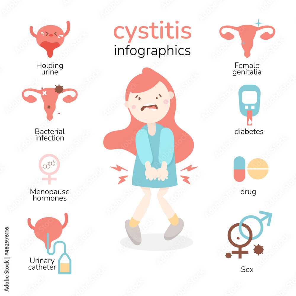 cystitis infographics. Symptoms and reasons of the disease. Stock ...