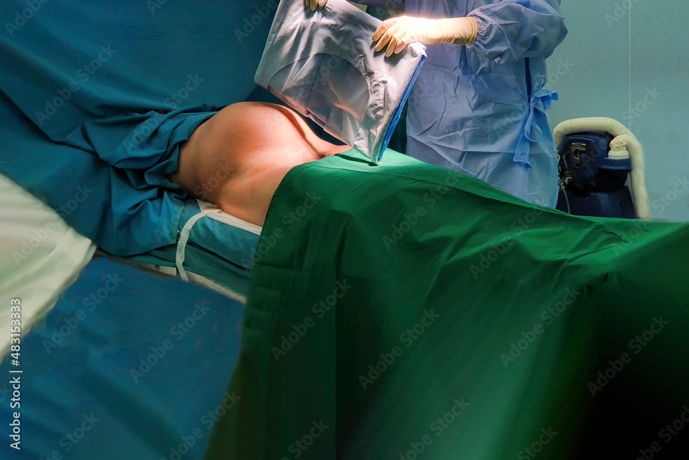 Caesarean section, Scrub nurse preparing the abdomen, cleaning and ...