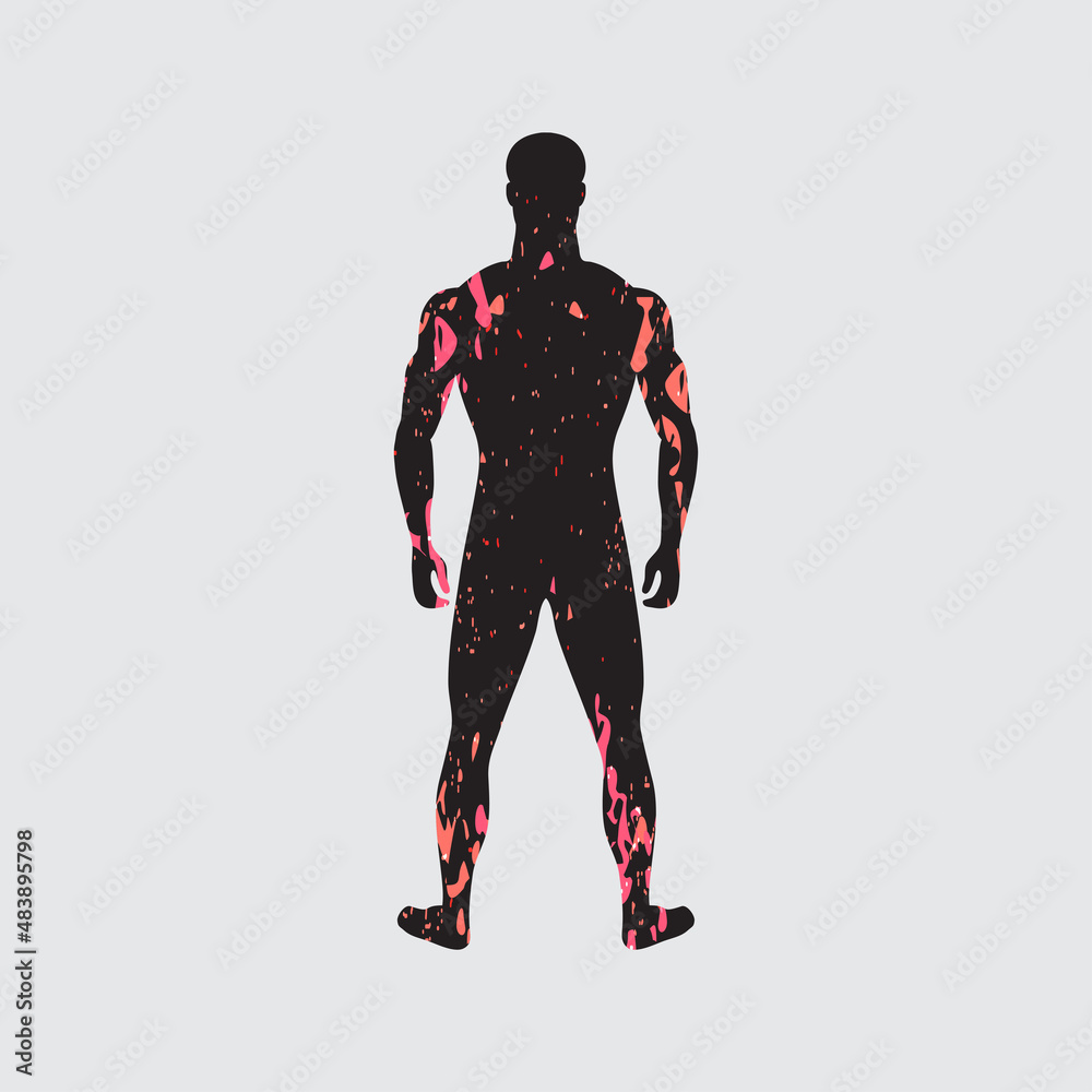 Meningitis rash on darker skin tones. Ethnic minorities skin diseases ...