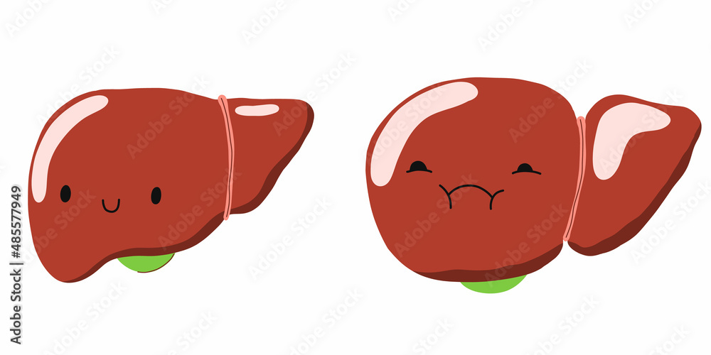 Liver disease. Cirrhosis. Sick and healthy liver character ...