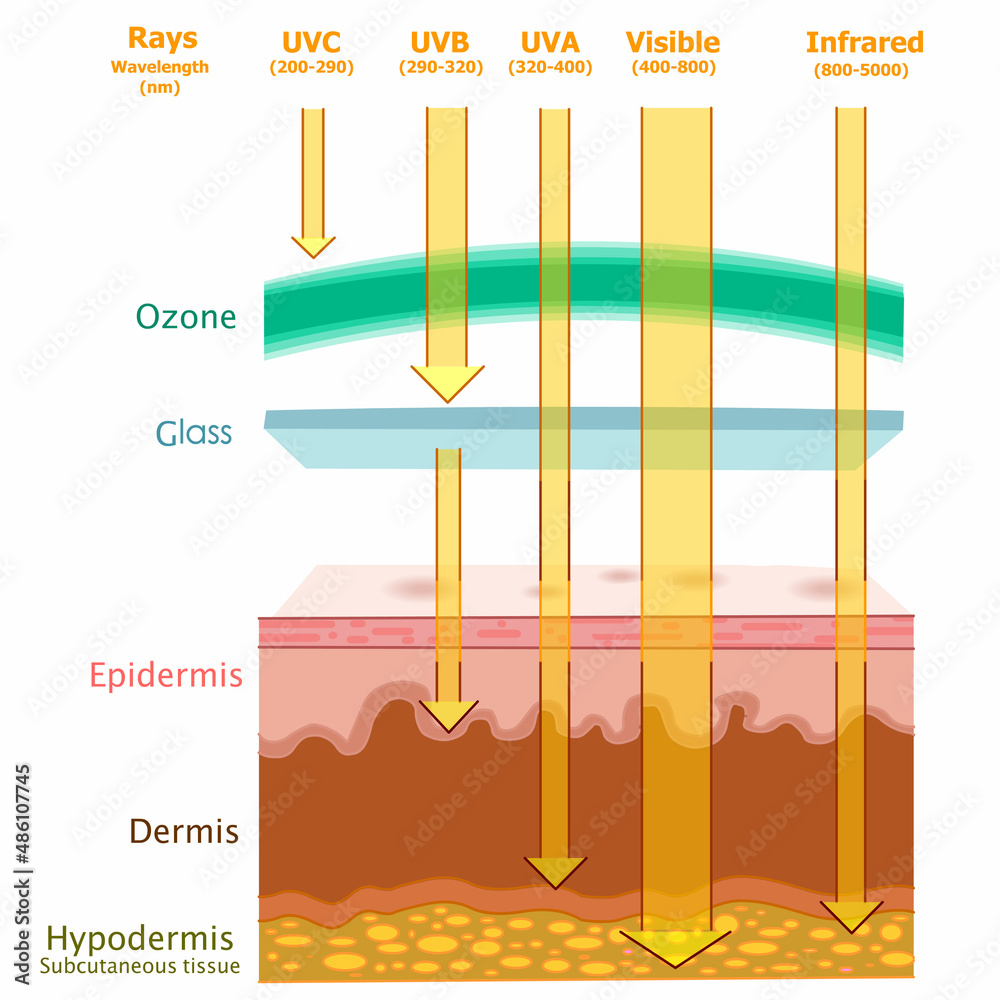 Ultraviolet radiation influenced, human skin layers damage. UVA, UVB ...