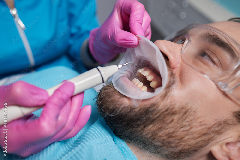 Macro photography. Top view on cleaning process in patient's mouth ...