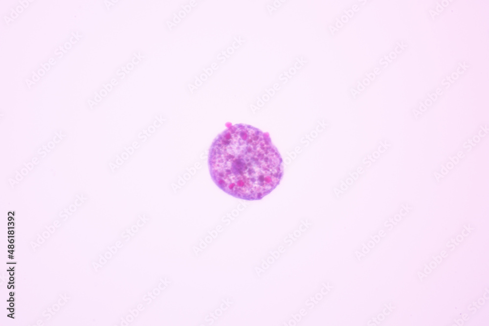 Blood smear shows macrophages on white background view in microscope ...