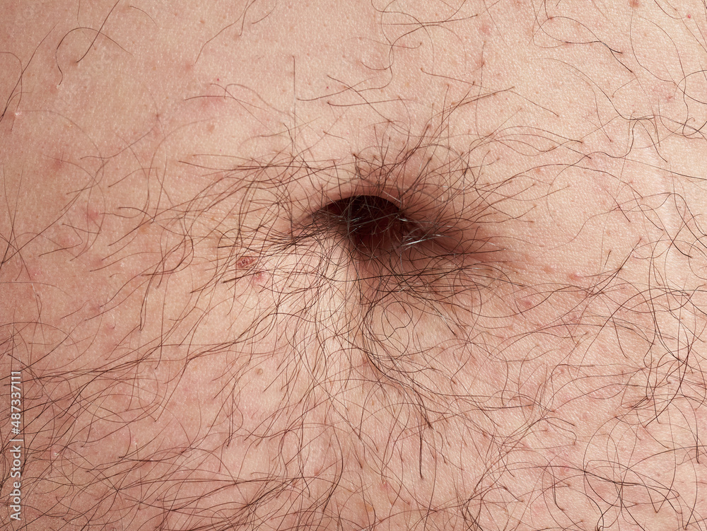 Hairy Navel On A Caucasian Man S Fat Belly No Faces Shown Nude Image