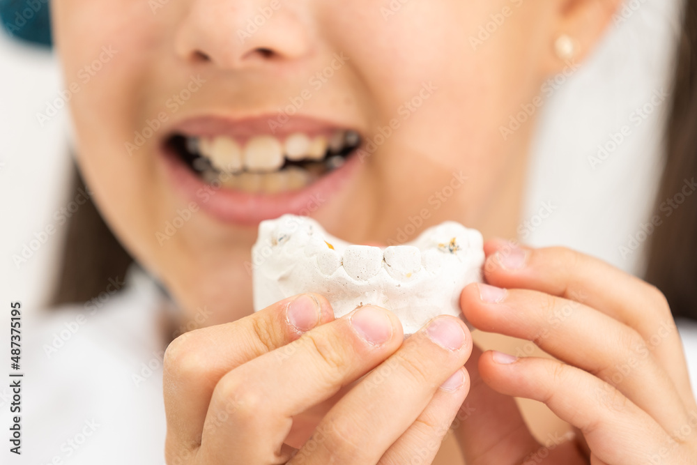 Teenager is holding a dental cast model at the start of orthodontic ...