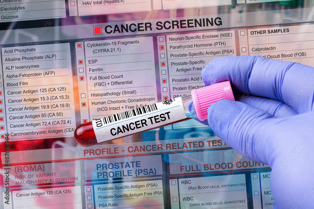 Blood tube test with requisition form for Cancer screening test. Blood ...