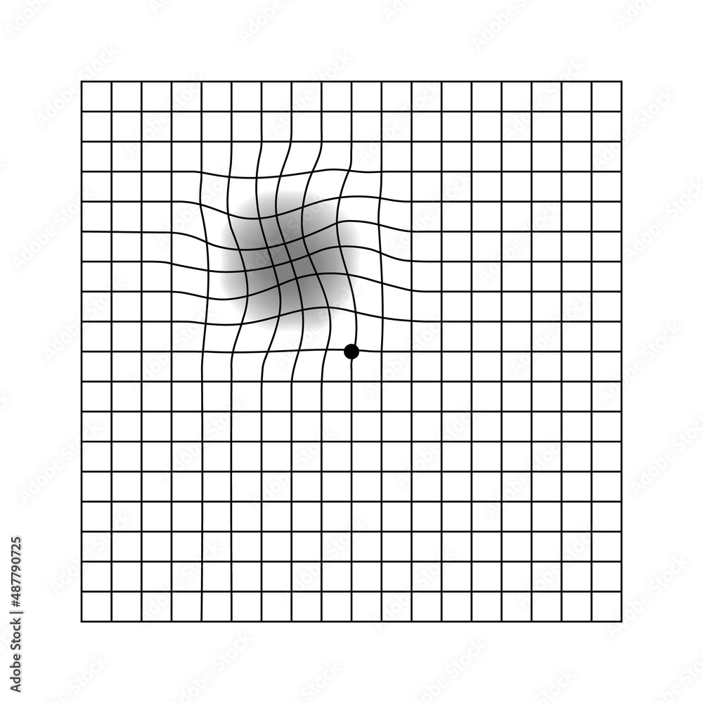 Amsler eye scotoma test grid. Vector printable chart retina examination ...