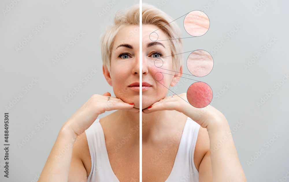 Professional cosmetology and plastic surgery. Portrait of a adult ...