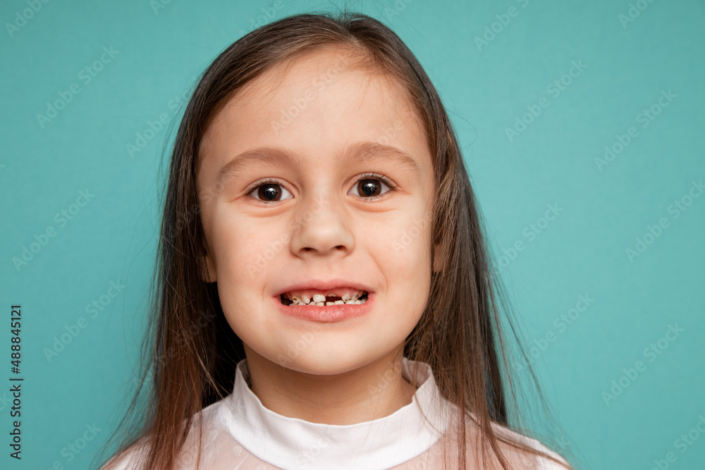 Cheerful cute child with teeth dropped out - preschooler girl with open ...