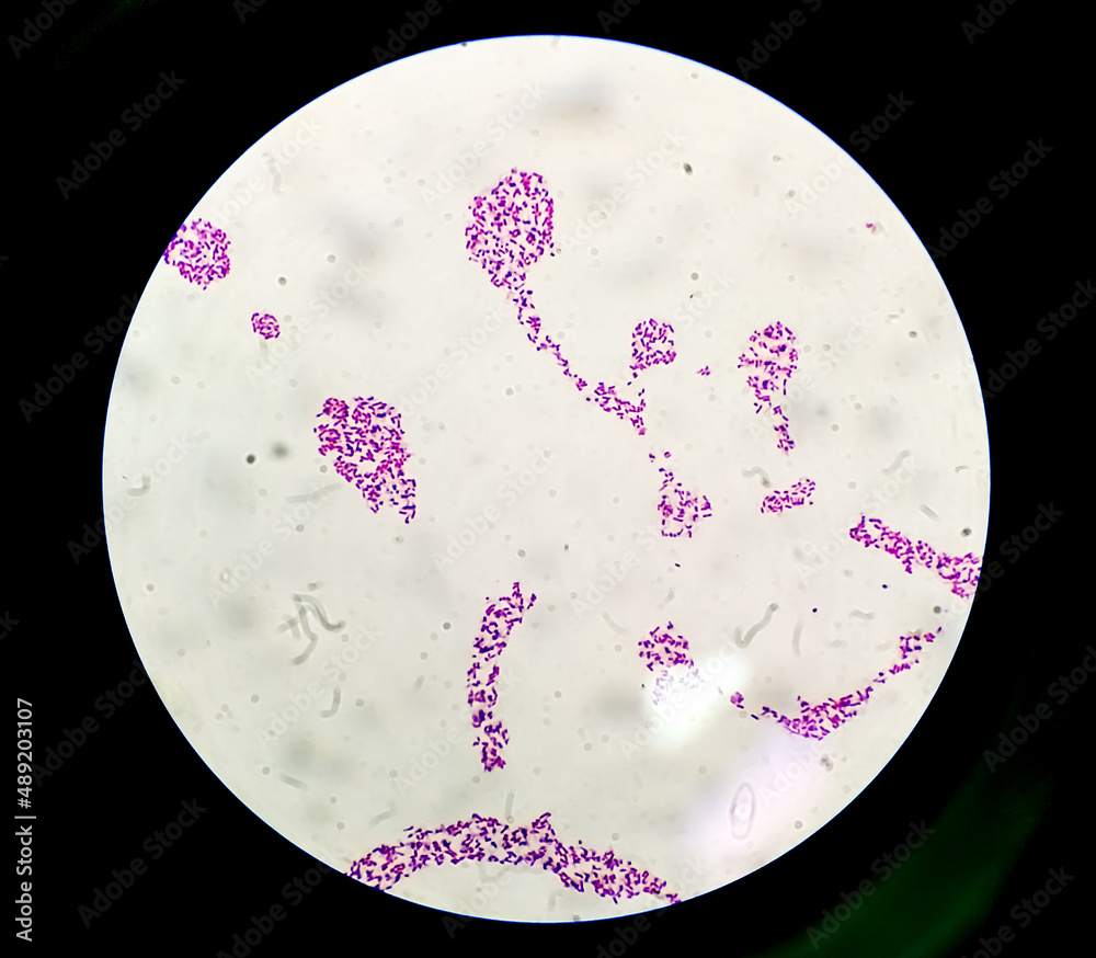 Blood agar bacterial colonies gram stained microscopic show Salmonella ...