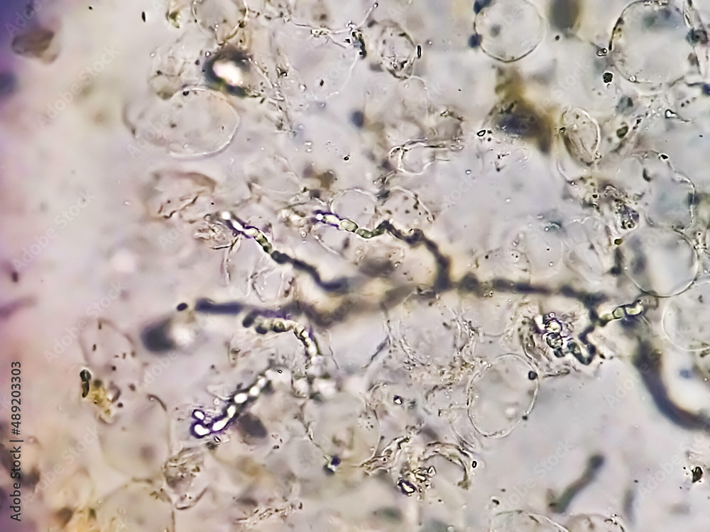 Microscopic image of dermatophytes. Skin scraping for fungus test Stock ...