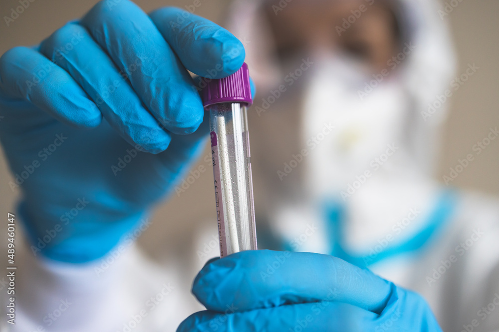 Process of coronavirus PCR antigen testing examination by nurse medic ...