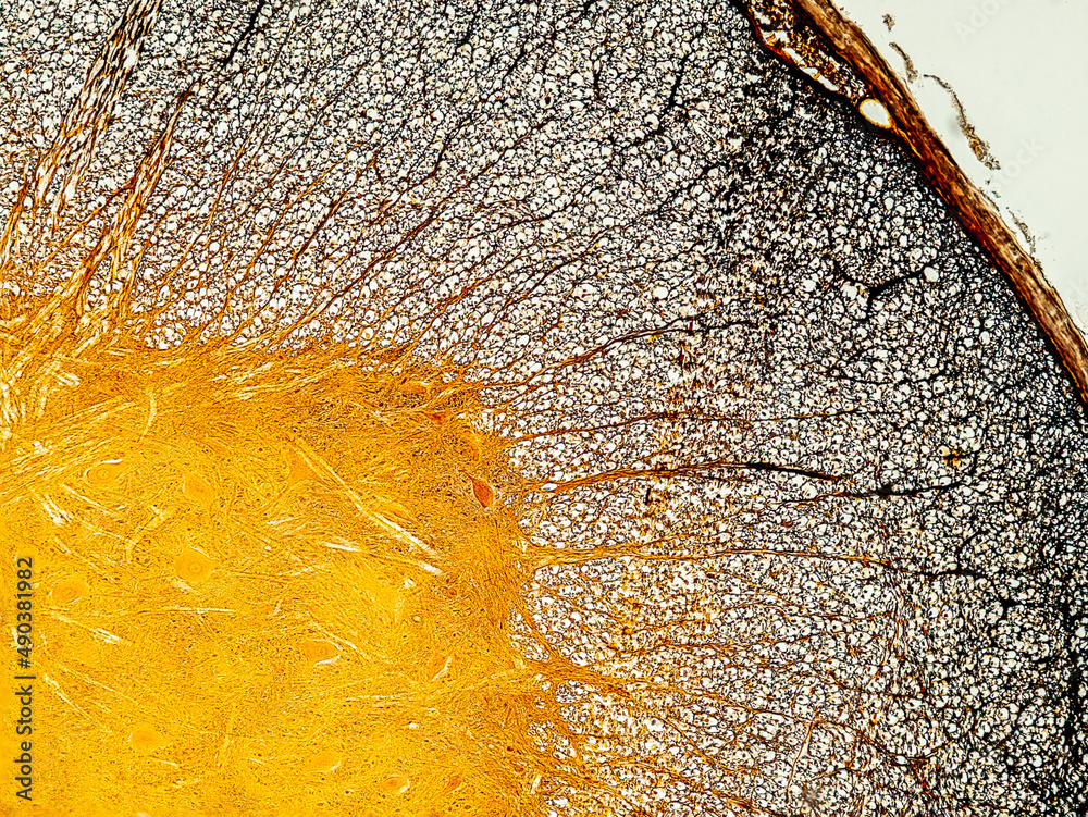 Spinal cord cross section under the microscope showing neurones and ...