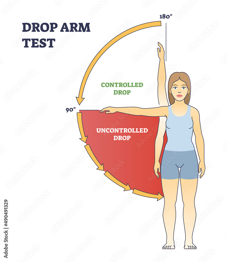 Drop arm test to diagnose medical physiopedia with arm movement outline ...