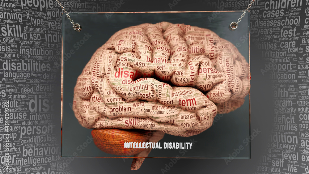 Intellectual disability anatomy - its causes and effects projected on a ...