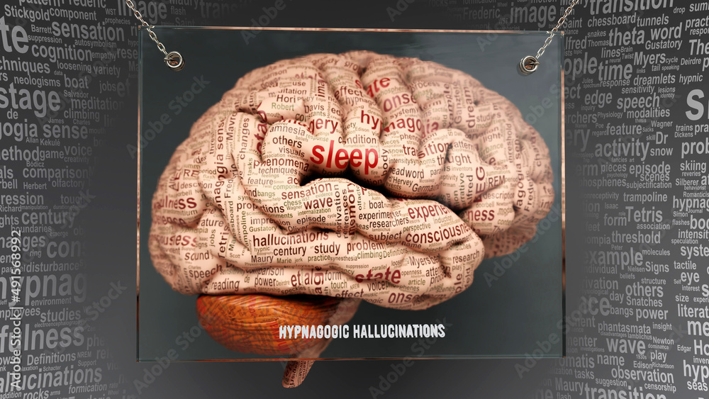 Hypnagogic hallucinations anatomy - its causes and effects projected on ...