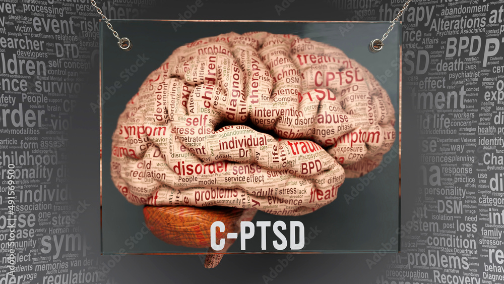 C ptsd anatomy - its causes and effects projected on a human brain ...