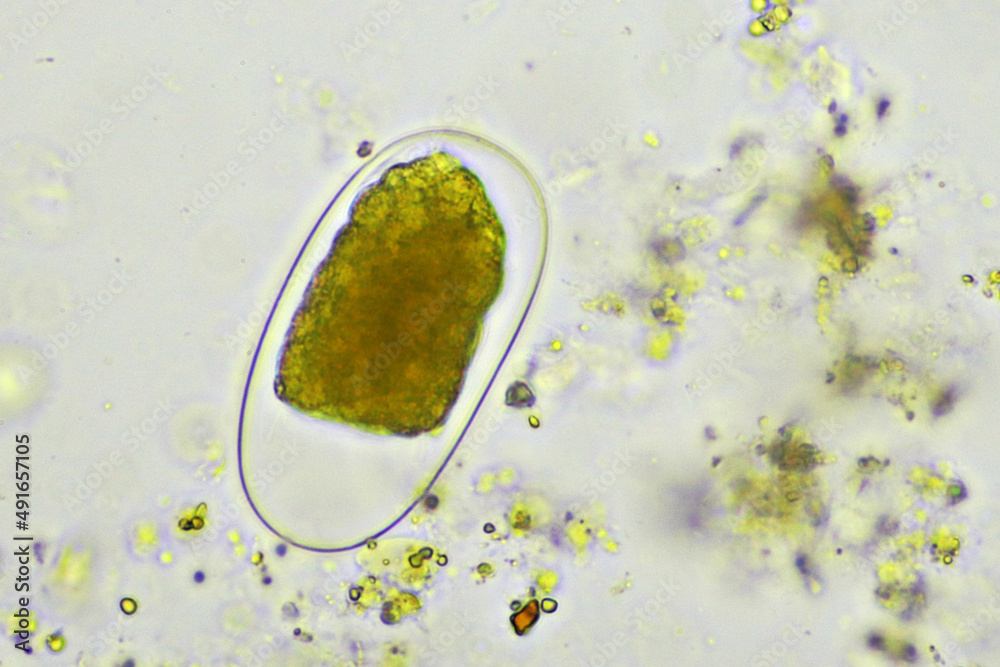 Eggs of Hookworm in human stool, analyze by microscope, original ...