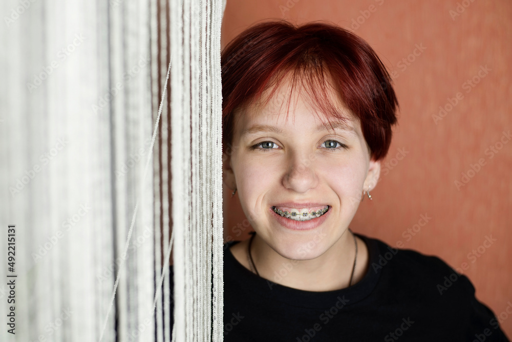Dental metal braces in teen girl on teeth, girl smiling and happy ...