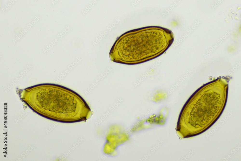 Egg of Trichuris trichiura (whipworm) in human stool, analyze by ...