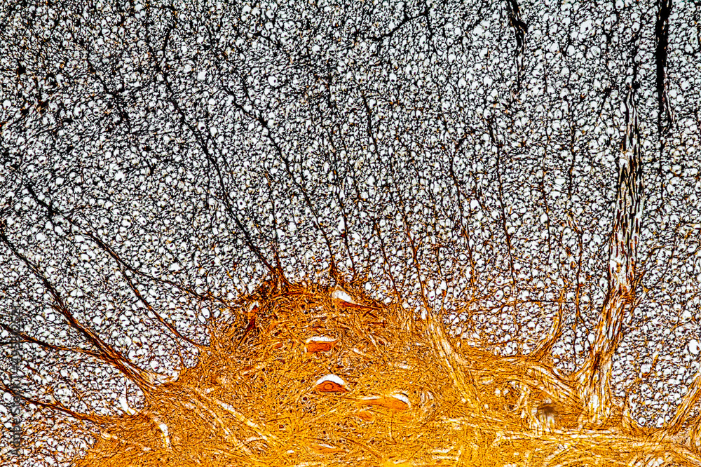 Spinal cord cross section under the microscope showing neurones and ...