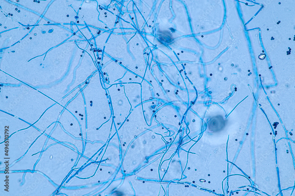 Aspergillus niger and Aspergillus oryzae (mold) under microscope for ...