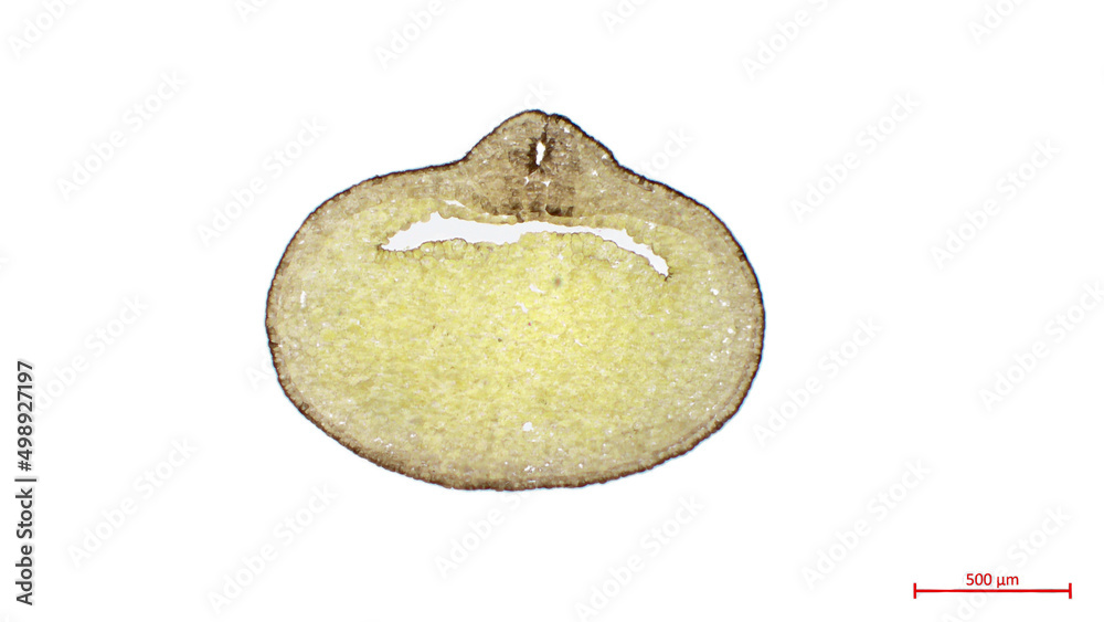 Neurulation, light micrograph (developing frog egg). Transverse section ...