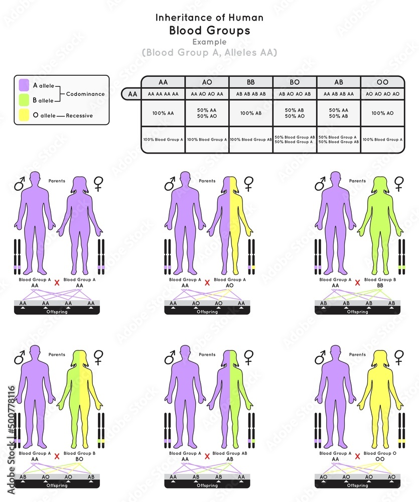 Inheritance of Human Blood Group A Infographic Diagram example alleles ...