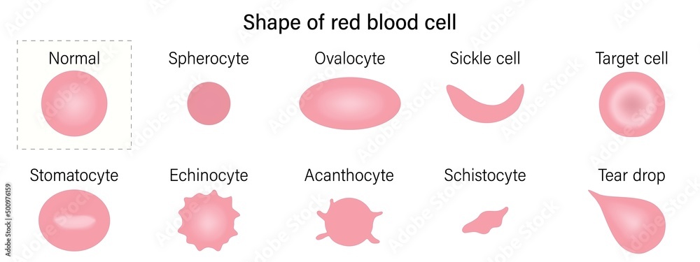 Red Blood Cell Morphology Types